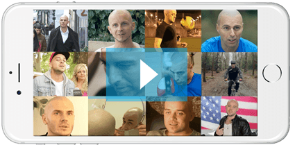 Scalp Micropigmentation Hair Tattoo Experts | UK and New York | Skalp®