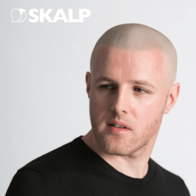 Scalp Micropigmentation For Fair Hair | SMP On Skin Types - Skalp