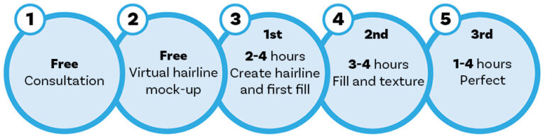 What is Scalp Micropigmentation? | Hair Tattoo (SMP) | Skalp