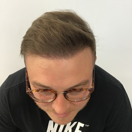 Hair Care Innovations for Fuller-Looking Hair - Skalp